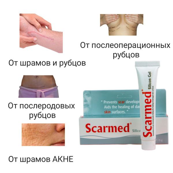 Гель от растяжек, шрамов, рубцов Scarmed 15г - купить с доставкой по ...