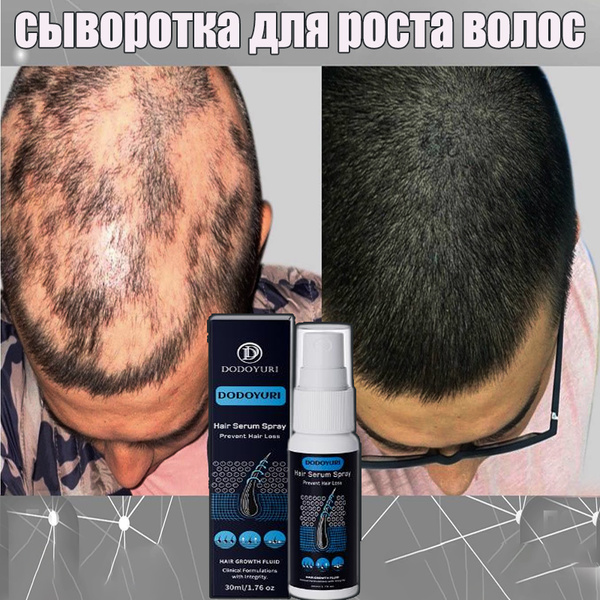 DODOYURI средство для роста волос, Эффективно предотвращает выпадение ...
