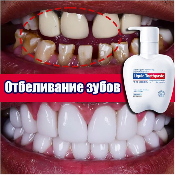 Зубная паста Бутик Xunyu купить на OZON по низкой цене (1867701948)