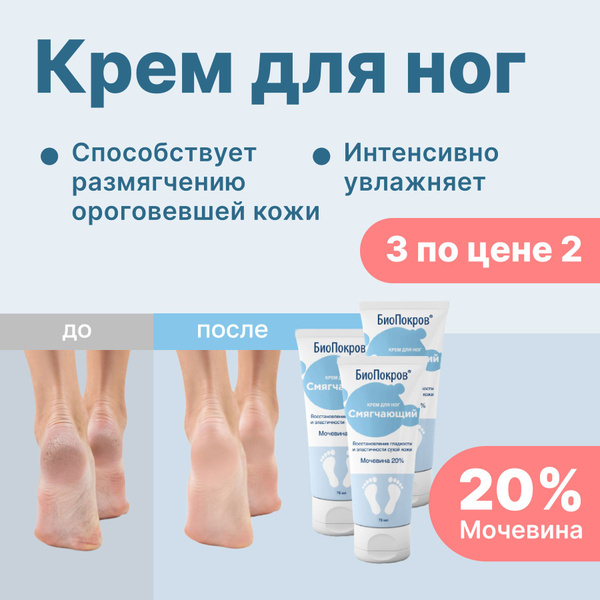 Крем для ног с мочевиной 20% увлажняющий и восстанавливающий при ...