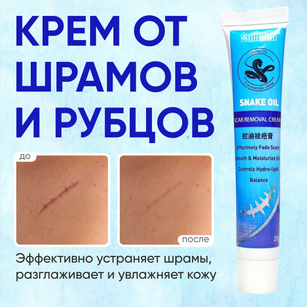 Крем от шрамов и рубцов, ожогов, постакне и растяжек Sumifun ...