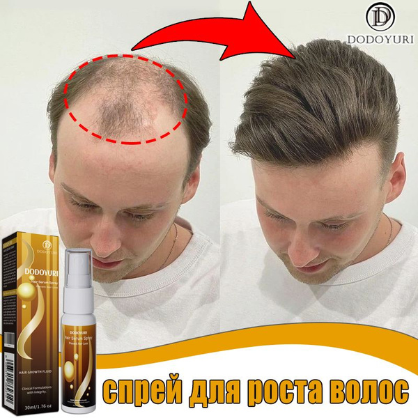 DODOYURI Спрей для роста волос и от выпадения волос средство 30мл ...