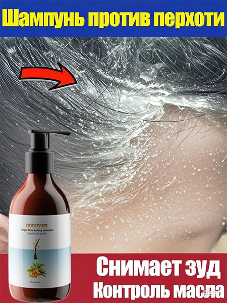 DODOYURI противогрибковый шампунь от перхоти, против псориаза, себореи ...