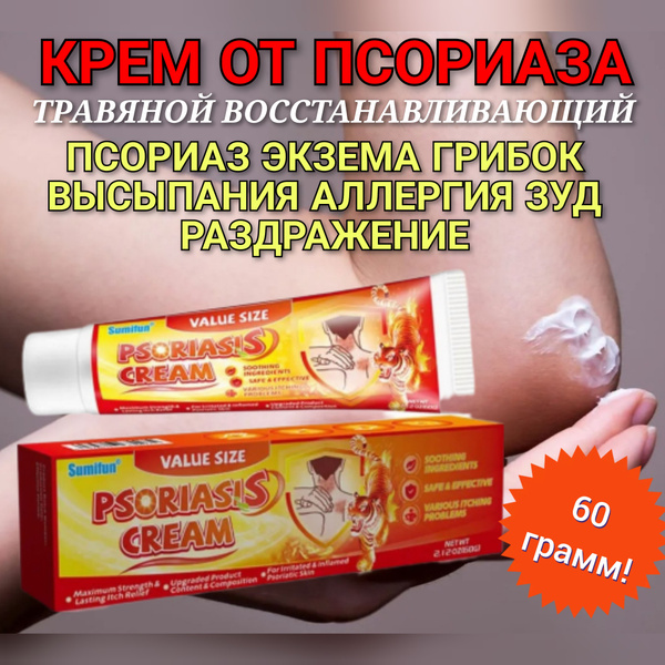 Крем мазь от псориаза, экземы, дерматита, высыпаний, аллергических ...