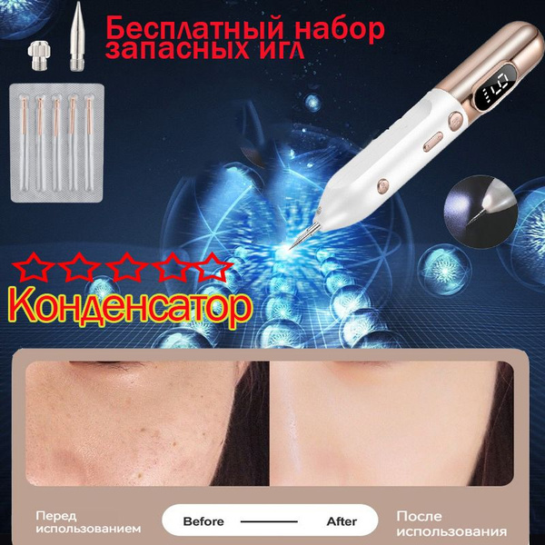 Лазерная ручка от папиллом и бородавок / Плазменная ручка для удаления ...