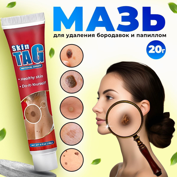 Средство от папиллом и бородавок, крем от шрамов и рубцов, мазь от ...