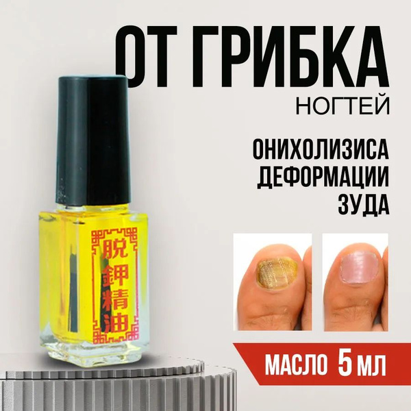 2 бутылки Средство от грибка ногтей на ногах и руках / масло от грибка ...