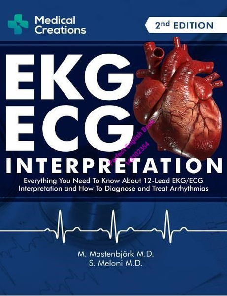 EKG/ECG Interpretation: Everything you Need to Know about the 12 - Lead ...