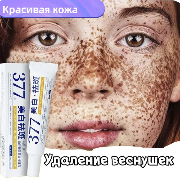 Отбеливающий крем против веснушек 30 г осветление и удаление ...