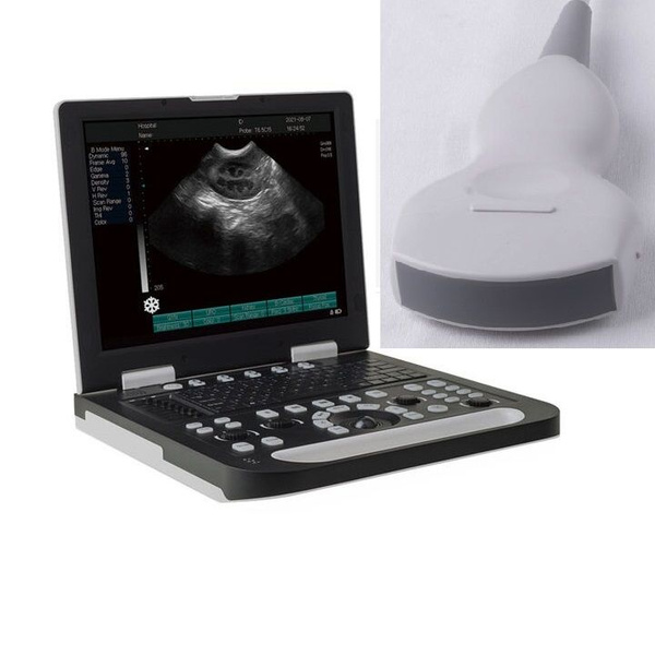 Характеристики BN102_Convex-Probe ветеринарный ультразвуковой сканер в ...