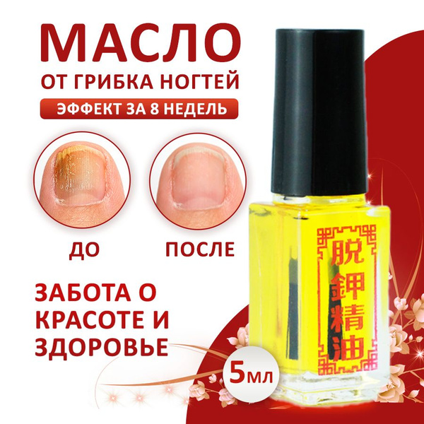 Средство против грибка ногтей на ногах и руках / средство от грибка ...