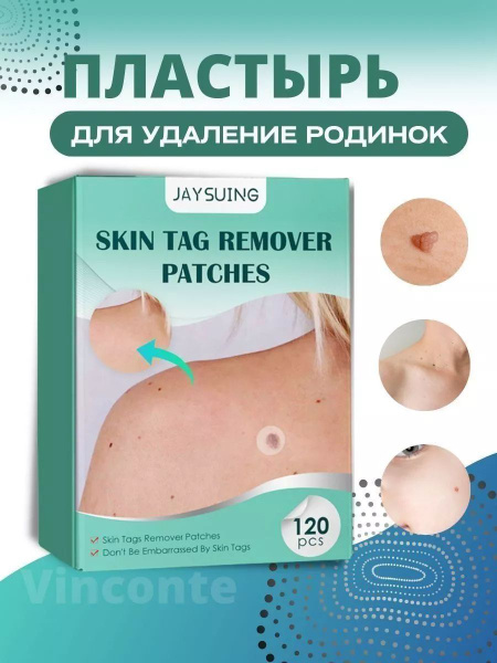 Пластыри для удаления бородавок/120 шт.Профилактическое средство ...
