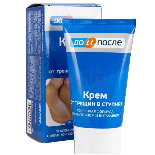 ДО и ПОСЛЕ Крем для ног от трещин в ступнях туба 150 мл/1 шт купить на ...