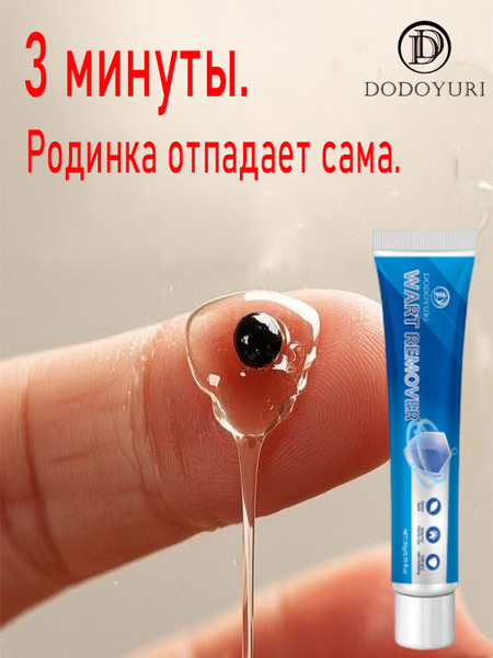 DODOYURI Мазь от бородавок, Крем средство для удаления бородавок ...