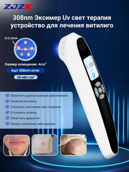 Характеристики ZJZK Фототерапия подробное описание товара. Интернет ...
