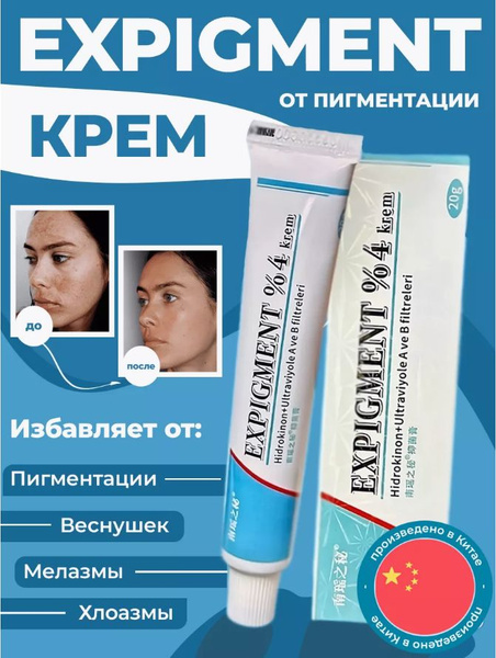 Expigment отбеливающий крем для лица от пигментации 4% купить на OZON ...