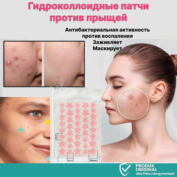 Патчи от прыщей - купить с доставкой по выгодным ценам в интернет ...