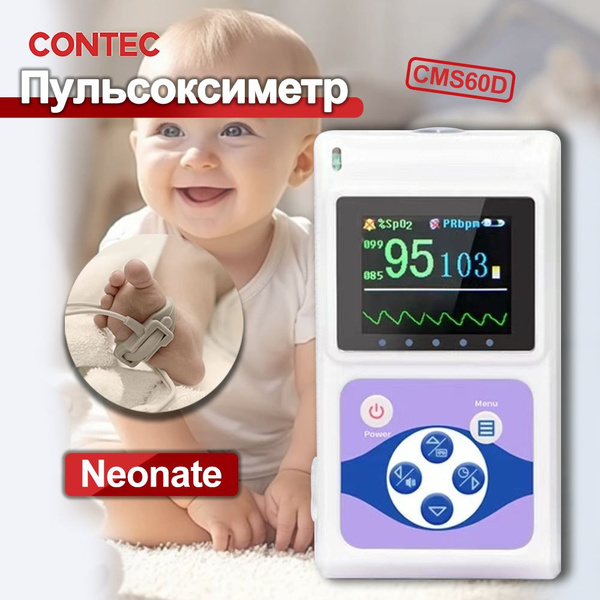 Пульсоксиметр CONTEC CMS60D Neonate - купить с доставкой по выгодным ...