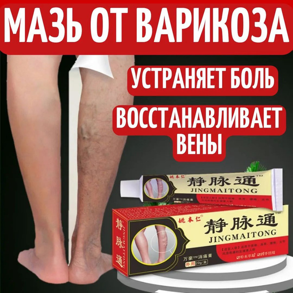 Китайская мазь от варикоза вен на ногах Джинг Май Тонг купить на OZON ...
