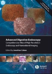 Advanced Digestive Endoscopy - Comprehensive Atlas of High Resolution ...