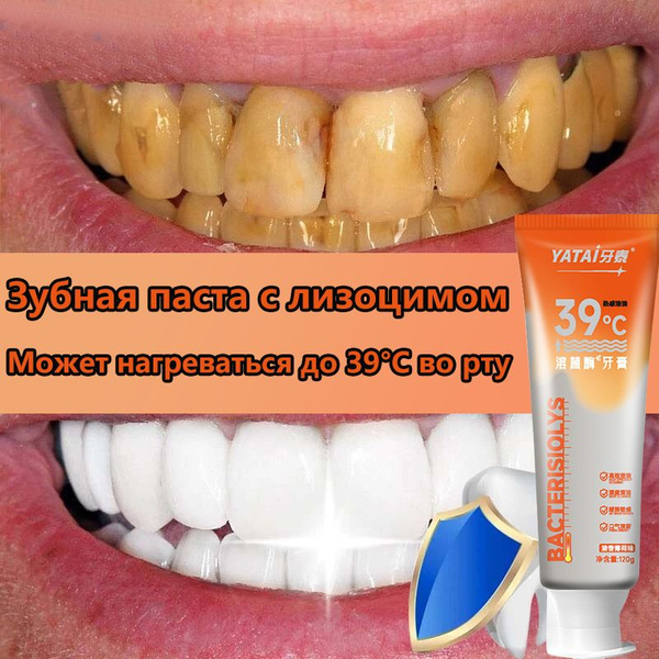 Антибактериальная отбеливающая зубная паста с новейшей технологией ...