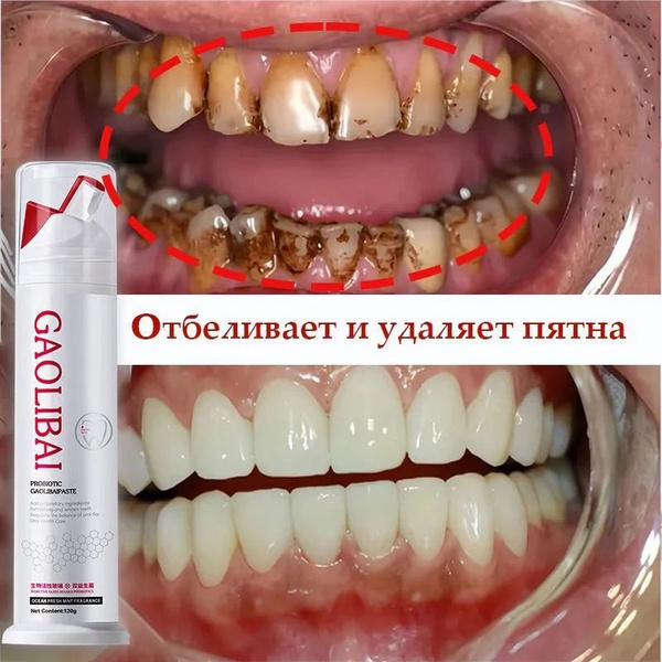 GAOLIBAI Фтором Зубная паста отбеливающая 120 г защищает зубную эмаль и ...
