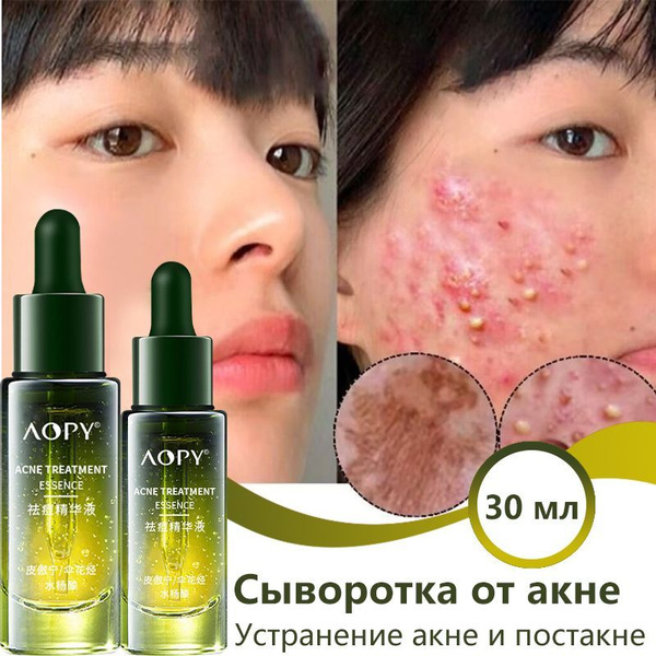 восстановление прыщей Эссенция для лица 30 мл Салициловая кислота ...