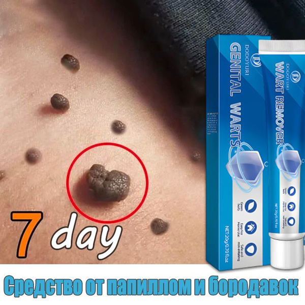 DODOYURI средство от бородавок Крем для удаления бородавок и родинок от ...