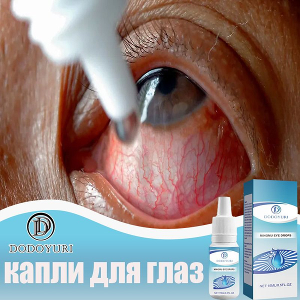 Глазные капли DODOYURI для ухода за глазами, снимают усталость, сухость ...