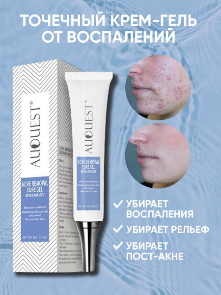 Крем от прыщей на лице, точечное средство, для подростков - купить с ...