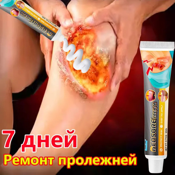Мазь от пролежней 20 г для лечения кожных язв у пожилых людей лежачих ...