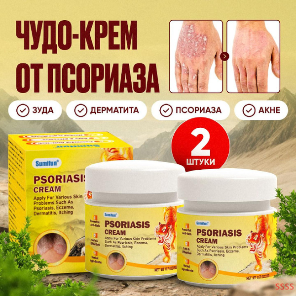 Мазь от ПСОРИАЗА, экземы, атопического дерматита / Китайская чудо мазь ...