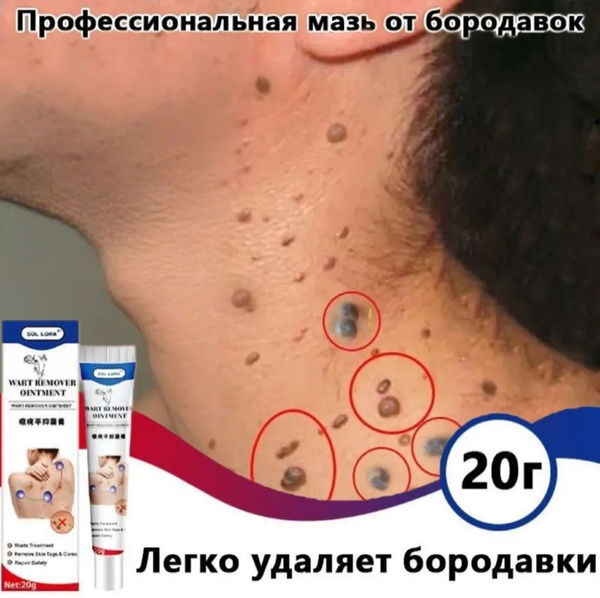 Крем от бородавок SOLLORA, 20 г, восстанавливает кожу купить на OZON по ...
