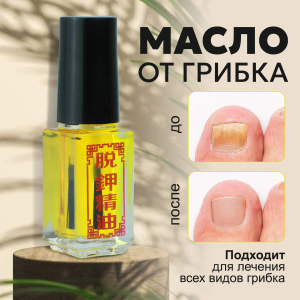 Средство от грибка ногтей на ногах, стоп онихолизис, 5мл купить на OZON ...