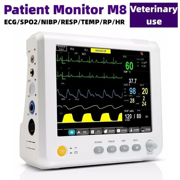 Монитор жизненно важных сигналов, 8-дюймов. ECG/NIBP/PR/SPO2/RESP/TEMP ...