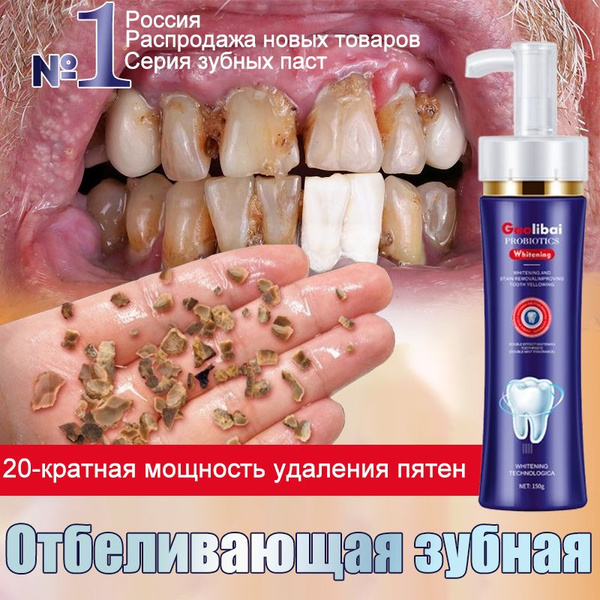 Зубная паста отбеливающая, от налета и кариеса на зубах взрослая для ...