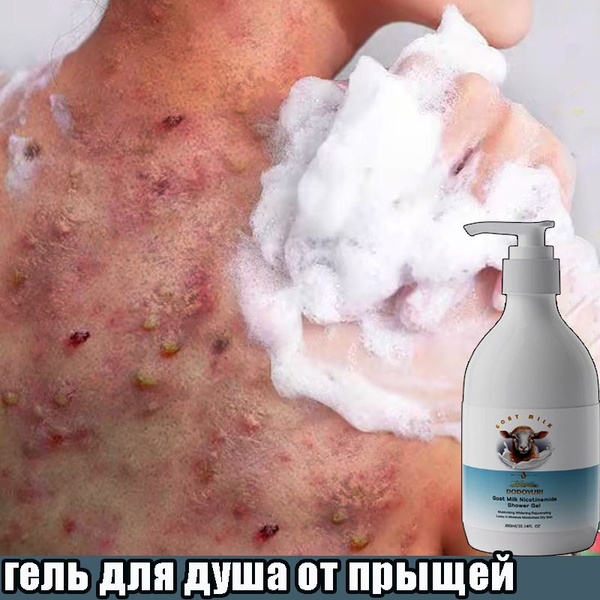 DODOYURI Гель для душа от прыщей, Глубоко очищает кожу тела, Быстро от ...