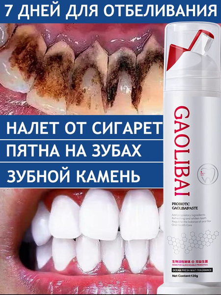 GAOLIBAI Интенсивное отбеливающая Зубная паста, от темного налета ...
