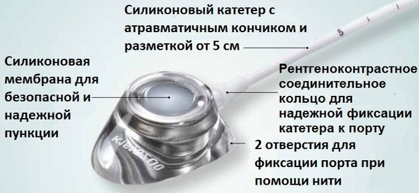 Порт-система Babyport Celsite Epoxy (SI)- эпоксид.смола/титан, силикон ...
