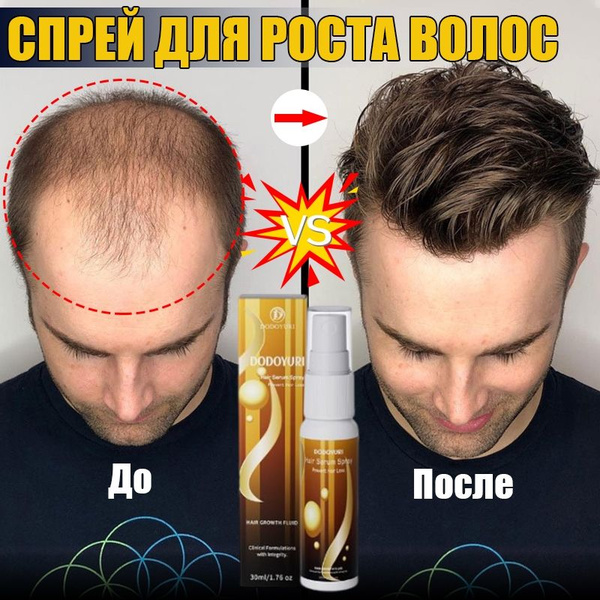 DODOYURI Спрей для роста волос и от выпадения волос средство 30 мл ...