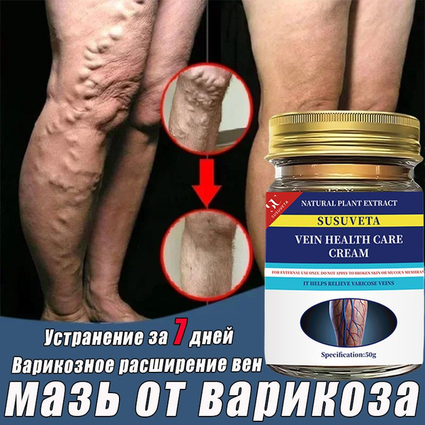 Крем от варикоза ног, венотоник от отеков и тяжести в ногах, для ...