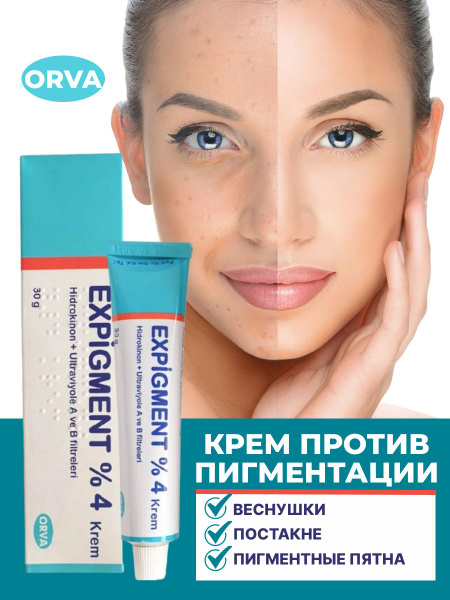 Крем от пигментных пятен Экспигмент купить на Ozon по низкой цене