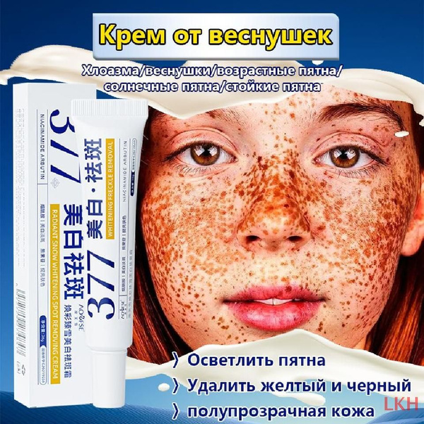 Отбеливающий крем против веснушек 30 г осветление и удаление ...