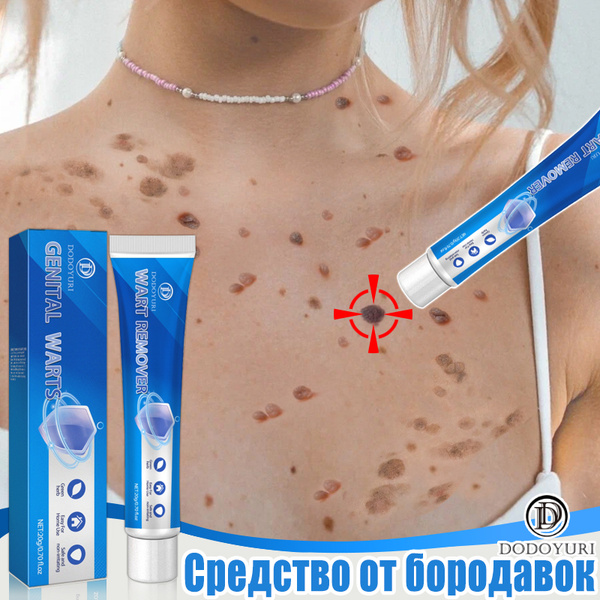 DODOYURI / Мазь от бородавок, Крем средство для удаления бородавок ...