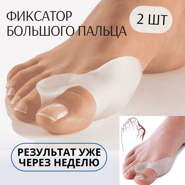 Бурсопротектор для пальца ноги 2 шт/ Фиксатор для большого пальца ...
