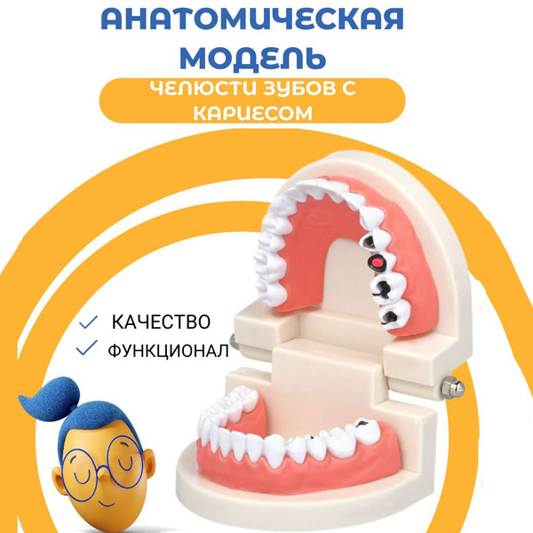 Анатомическая модель зубов, Зубная челюсть с кариесом / 3Д зубы для ...