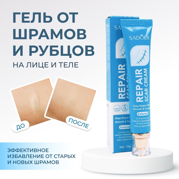 Заживляющий крем от шрамов, рубцов, ожогов, постакне. - купить с ...