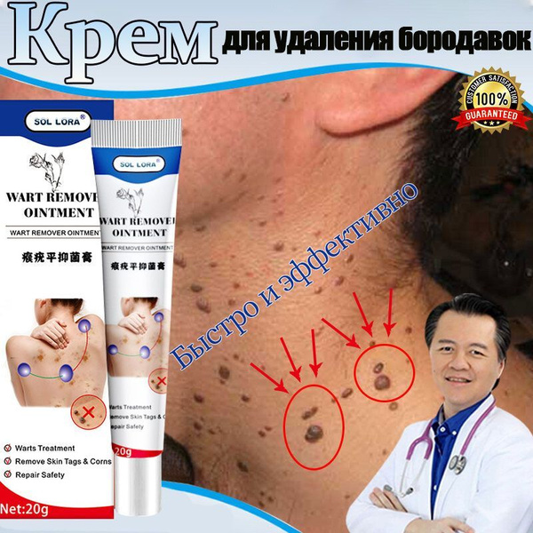 SOL LORA Крем для удаления бородавок и родинок, чистотел от бородавок ...