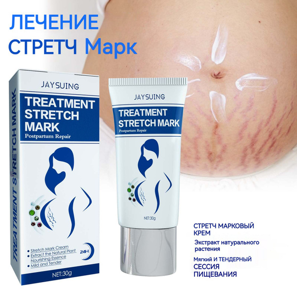 Jaysuing/крем от растяжек после родов/послеродовой укрепляющий крем для ...