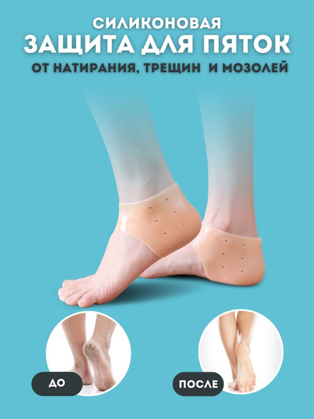 Напяточники силикон, Силиконовые носочки от трещин, от мозолей и ...